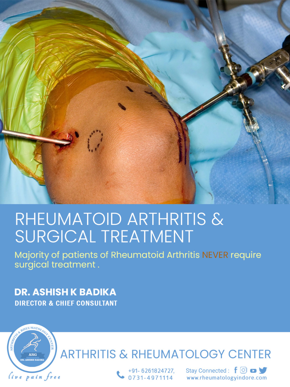 Rheumatoid Arthritis & Surgical Treatment in Indore, rheumatologyindore.com